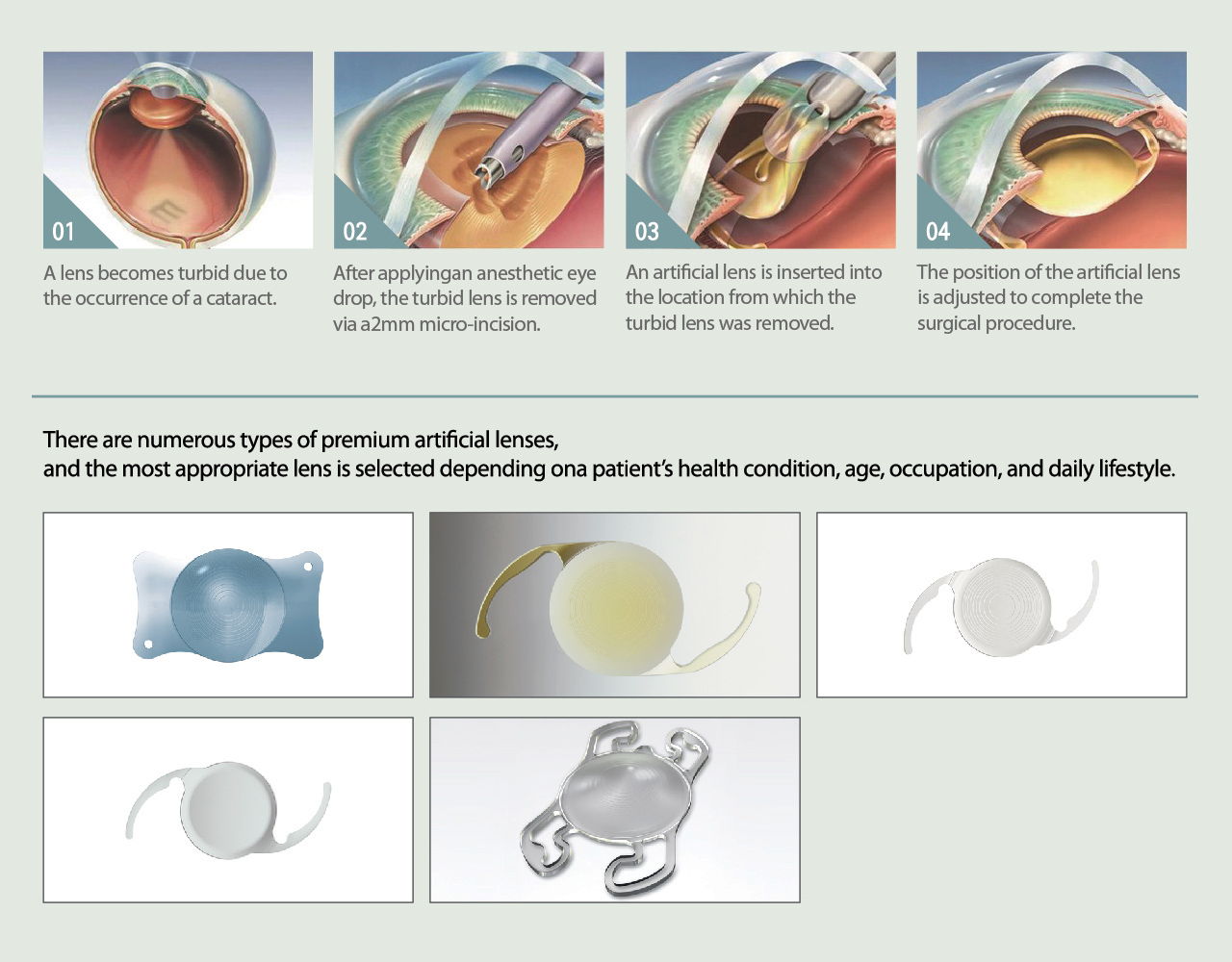 Cutting Edge Equipment Best equipment for safe, fast, and accurate surgery.